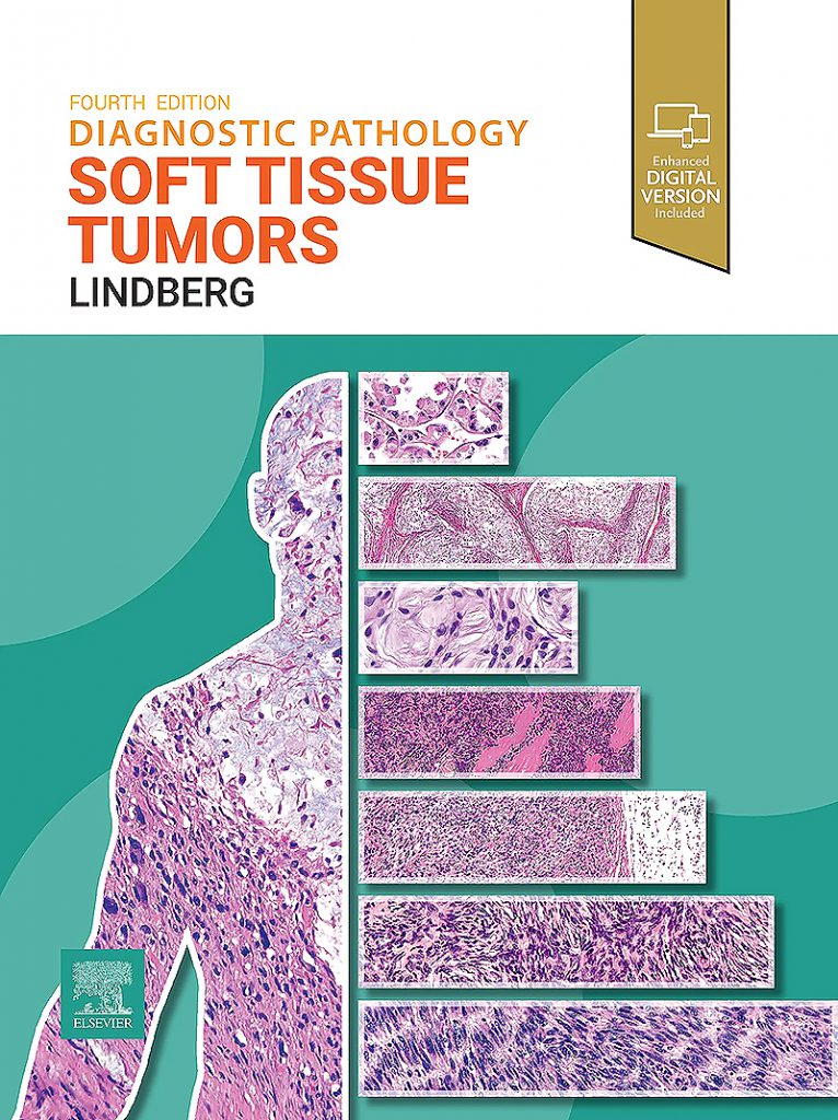 Diagnostic pathology. Soft tissue tumors